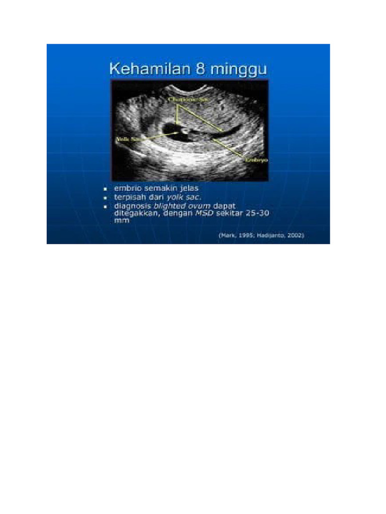 USG 8 Minggu | PDF