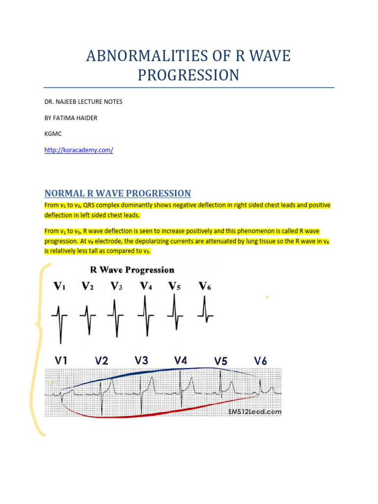 Abnormal R Wave Progression Explained | PDF | Cardiac Electrophysiology ...