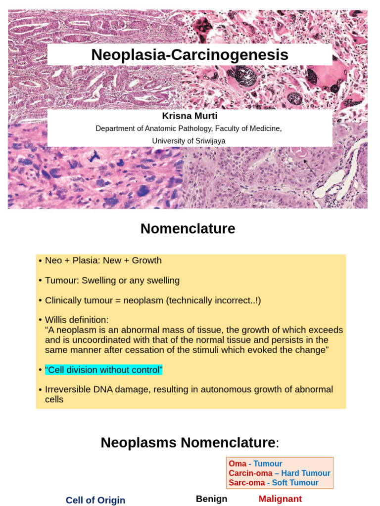Understanding Neoplasia and Carcinogenesis | PDF | Oncogene ...