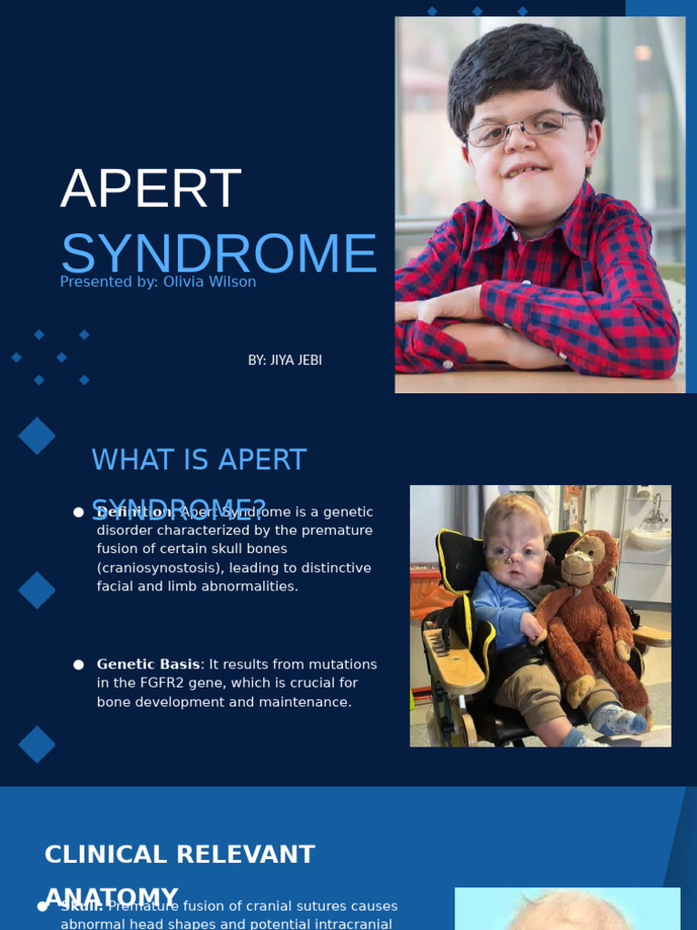 Apert Syndrome | PDF | Medicine | Causes Of Death