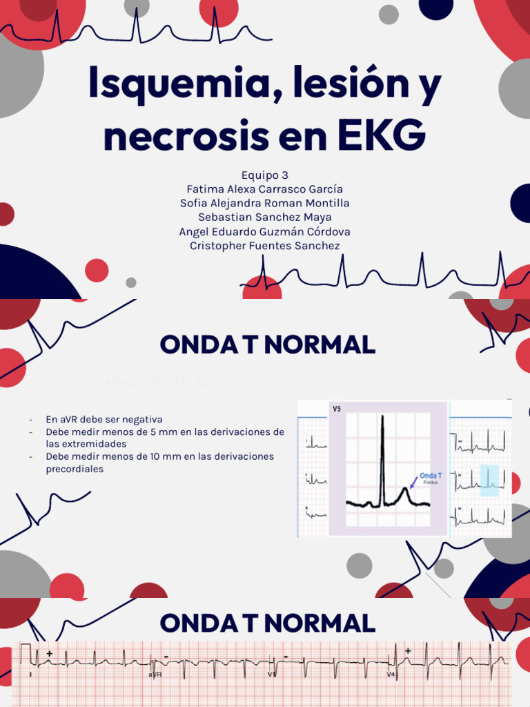 03 Isquemia, Lesión y Necrosis | PDF | Electrocardiografia | Fisiología ...