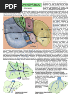 Sigmoidectomia Laparoscopica | PDF | Intestino grueso | Cirugía