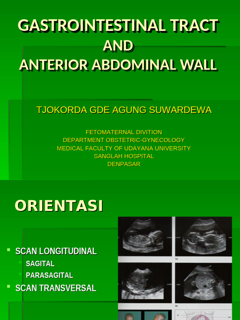 Anomalies of the Gastrointestinal Tract and Anterior Abdominal | PDF