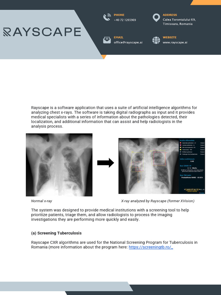 Rayscape - Rayscape For Tuberculosis Screening Romanian National Program | PDF | Radiology ...