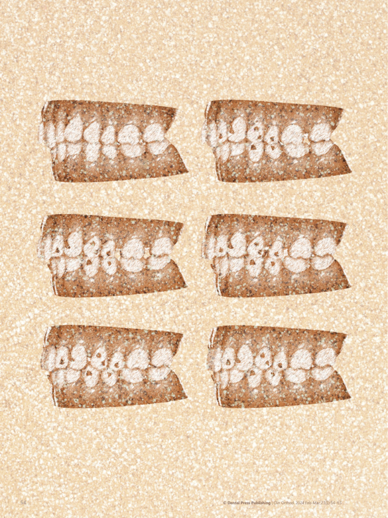 Class II Subdivision Treatment With Distalization Using Invisalign ...