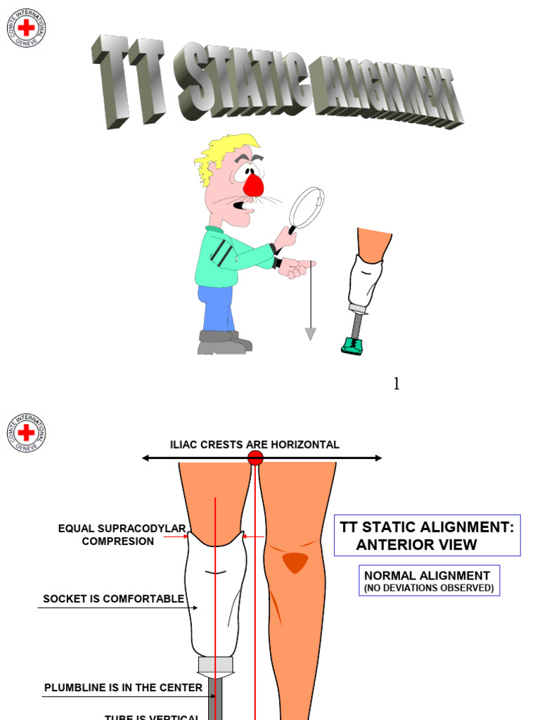 static alignment | PDF | Foot | Anatomical Terms Of Location