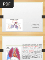 Criterios de Light para Derrames Pleural | PDF
