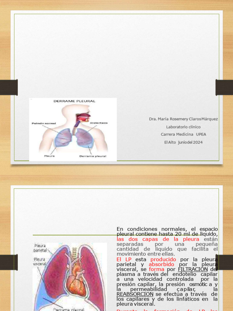 Causas de Trasudado y Exudado Pleural | PDF | Causas de la muerte ...