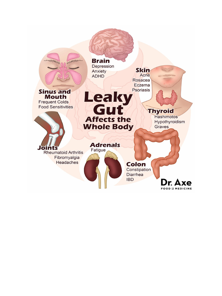 Leaky Gut Chart | PDF