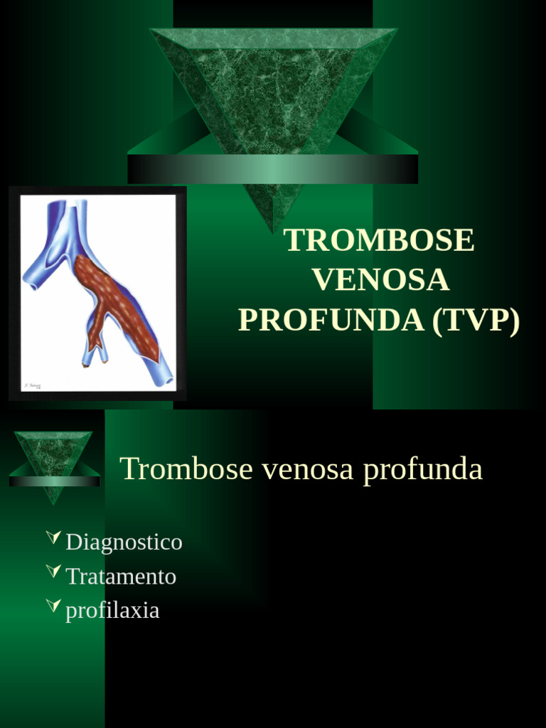 Trombose Venosa Profunda (TVP) | PDF