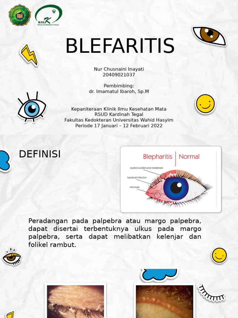 Blefaritis Materi | PDF