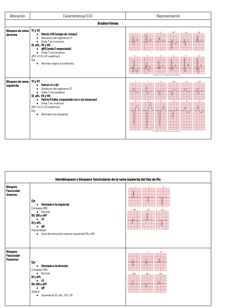 Trastornos de La Conducción EKG | PDF | Electrocardiografia | Fisiología
