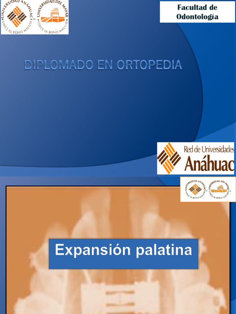 Expansión Maxilar | PDF