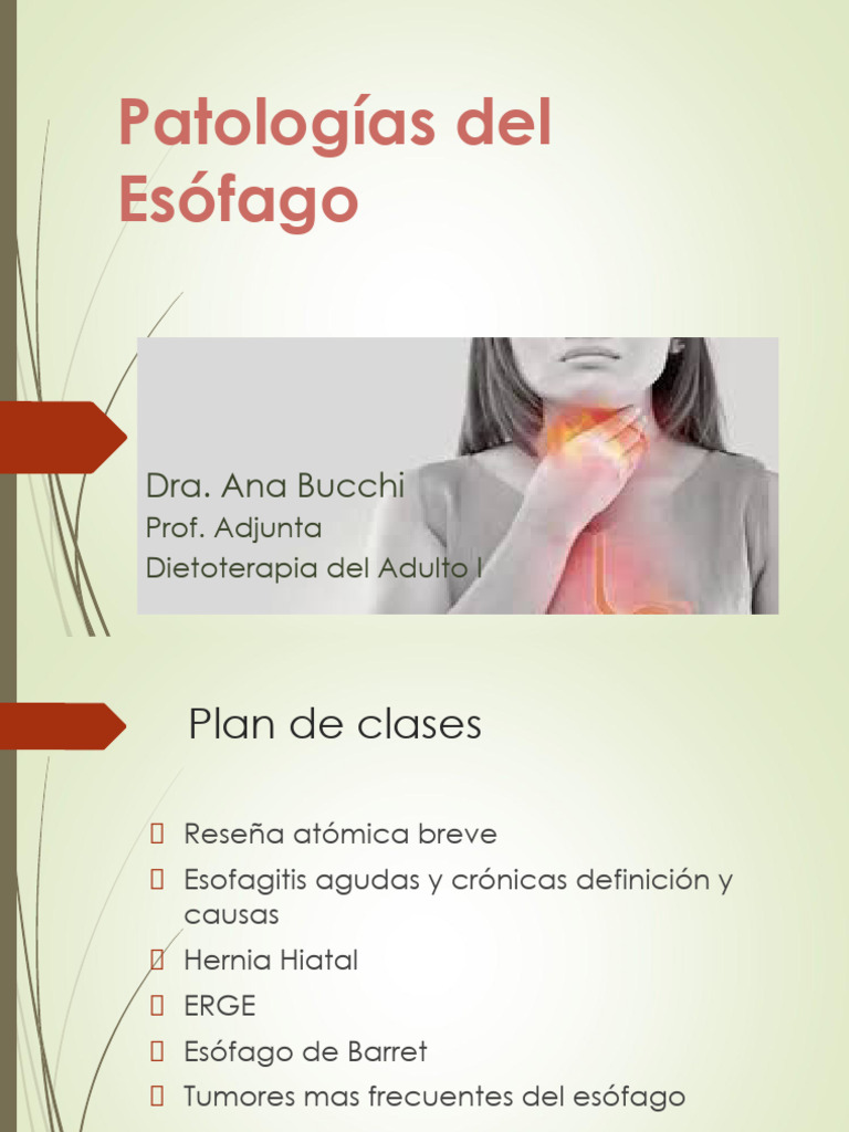 Esofago.ppt | PDF