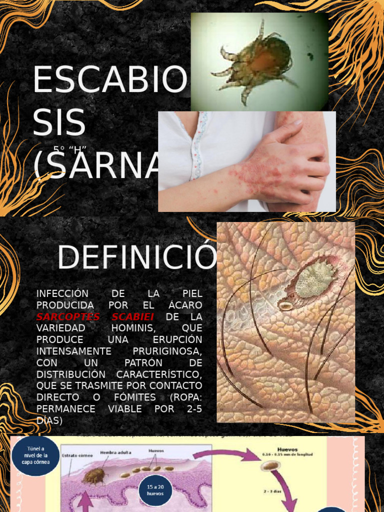 Escabiosis Sarna | PDF