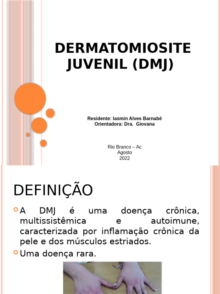 MDermatomiosite Juvenil (DMJ) | PDF