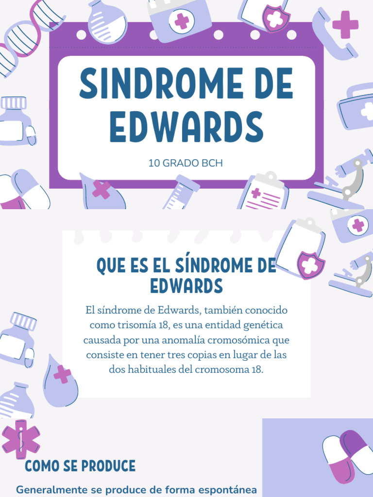 Sindrome de Edwards | PDF