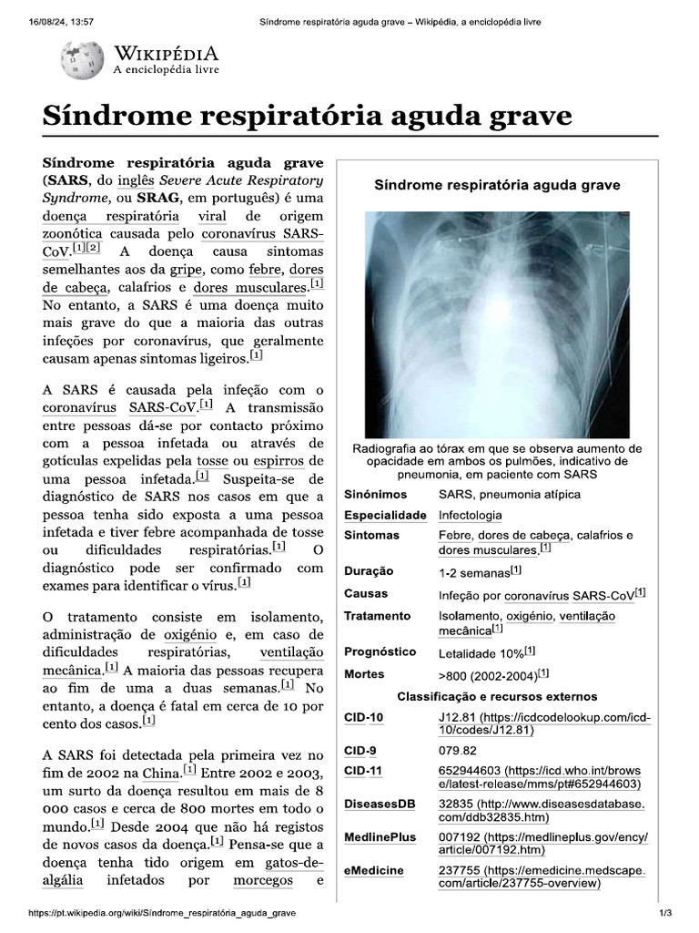 Tudo Sobre SARS | PDF