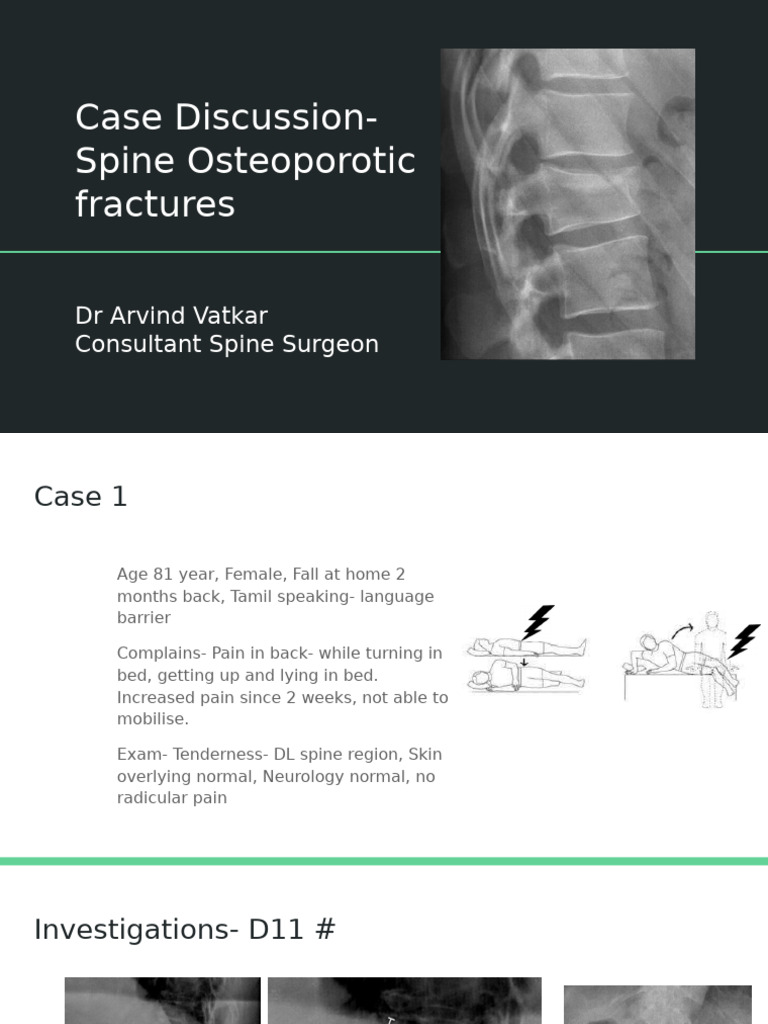 Case Presentation Osteoporosis Pdf