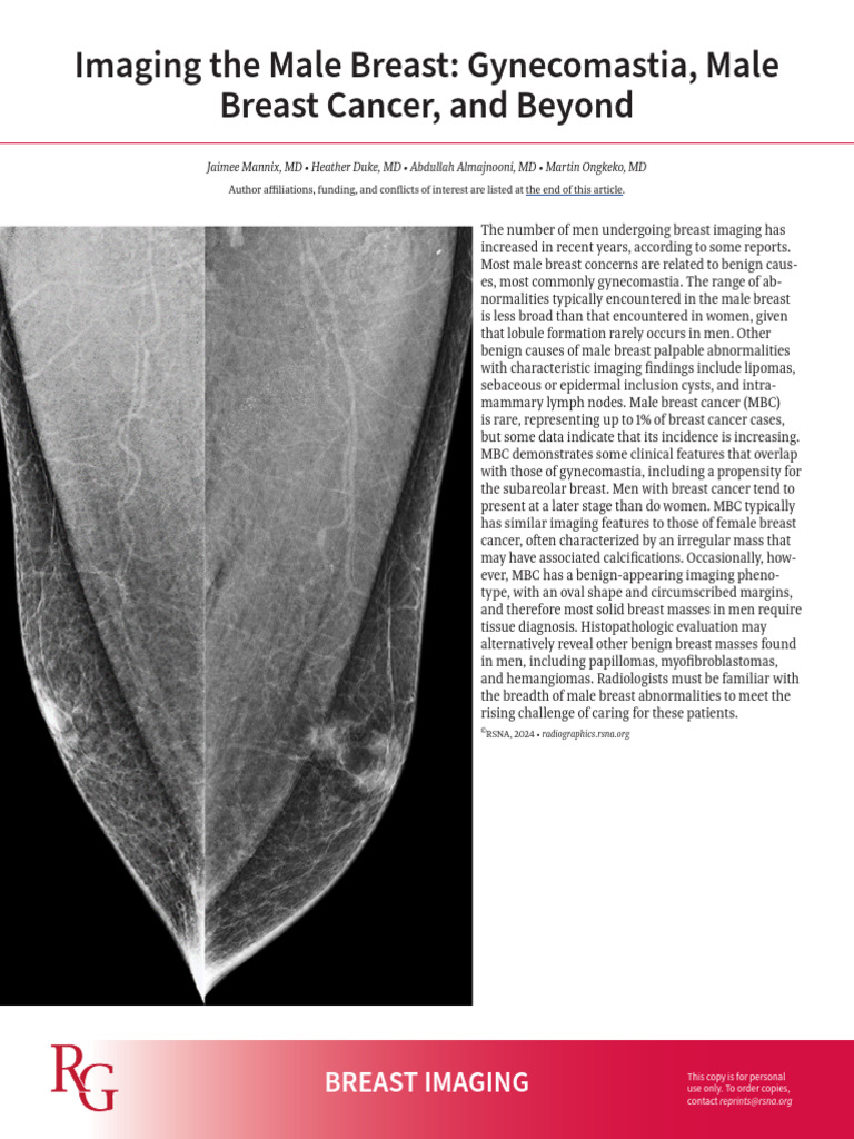 Mannix Et Al 2024 Imaging The Male Breast Gynecomastia Male Breast ...