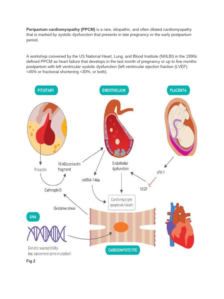 Peripartum Cardiomyopathy | PDF