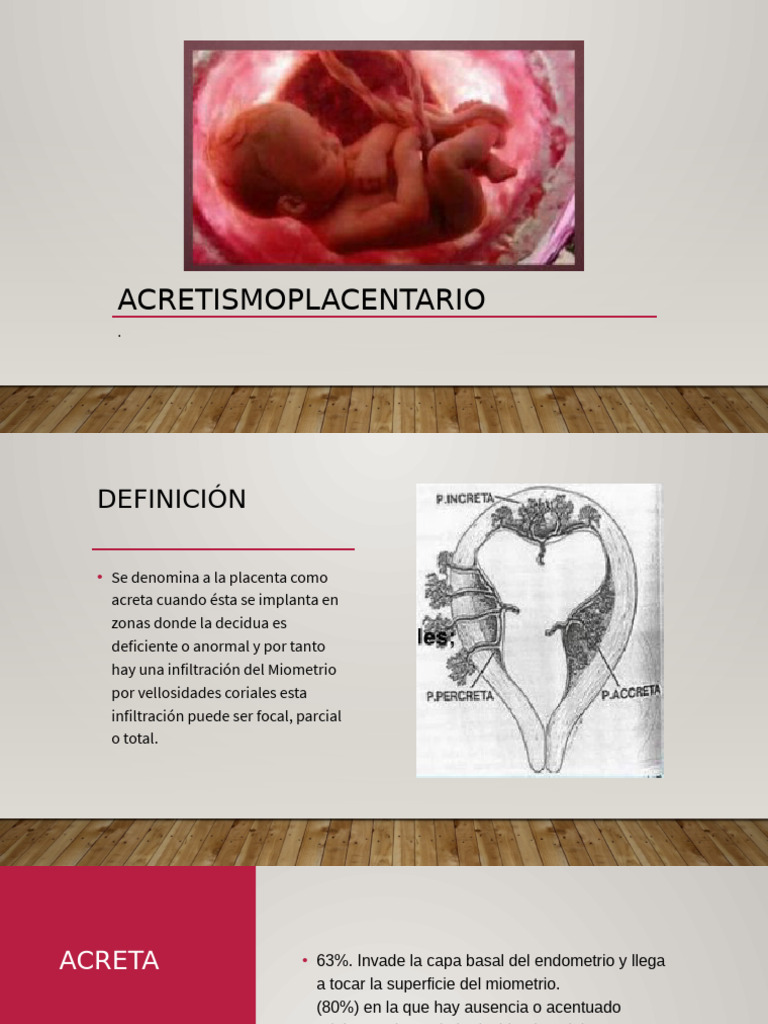 Acretismo Placentario: Definición y Tratamiento | PDF | Ultrasonido ...