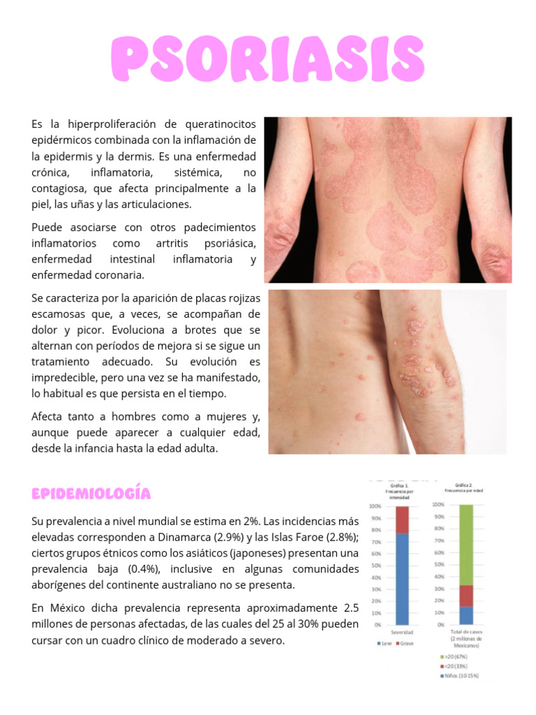 PSORIASIS | PDF