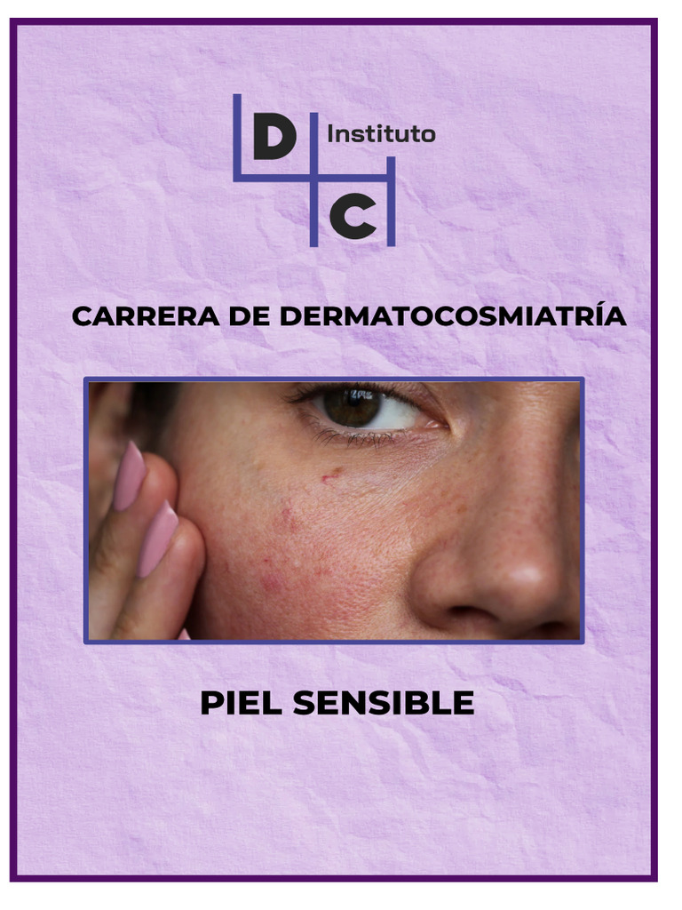 Piel Sensible Vertical | PDF