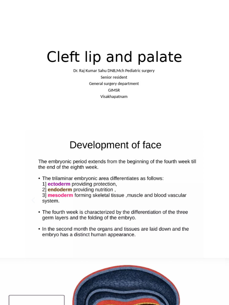 Cleft Lip | PDF