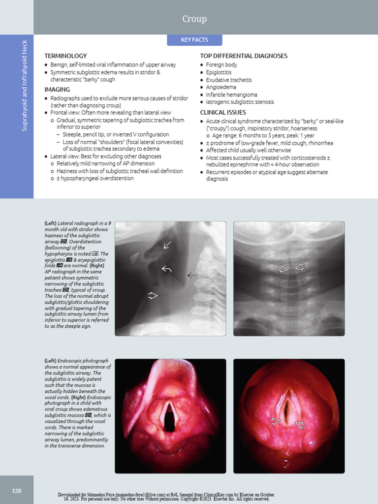 CROUP | PDF