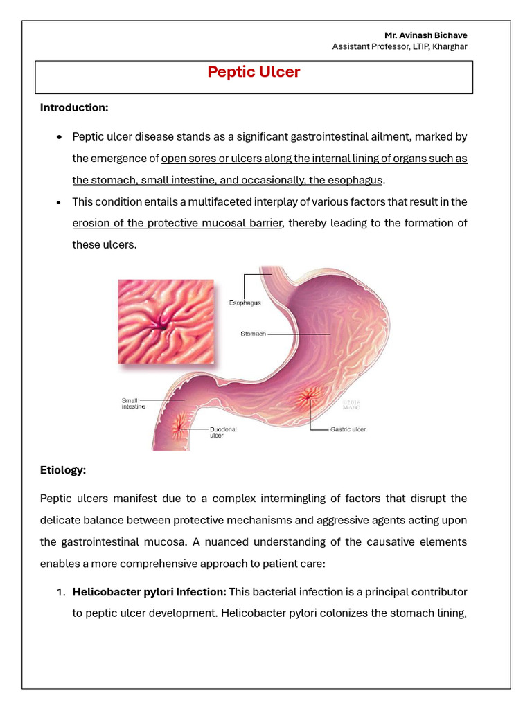 Peptic Ulcer | PDF