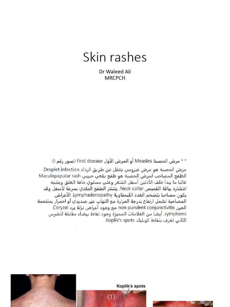 Skin Rashes DR Waleed | PDF