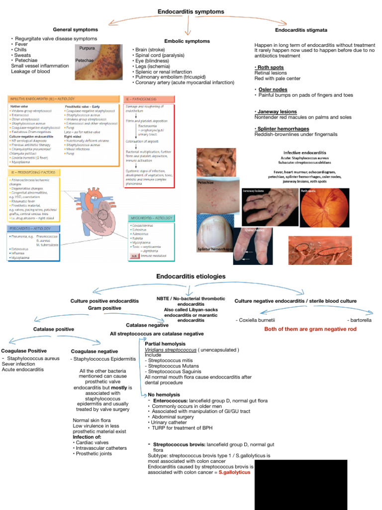 Endocarditis 1 | PDF
