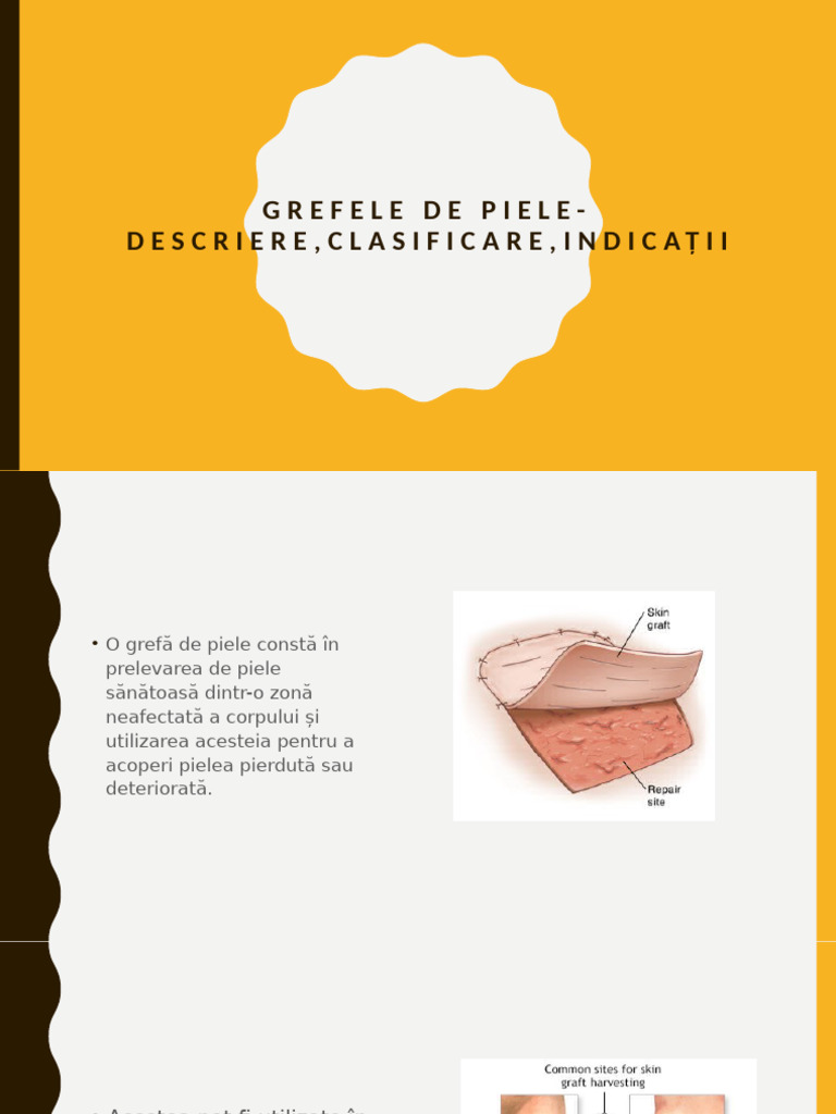 Arsuri - Copie | PDF