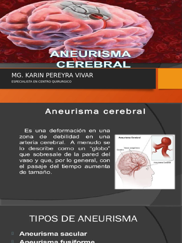 ANEURISMA CEREBRAL | PDF