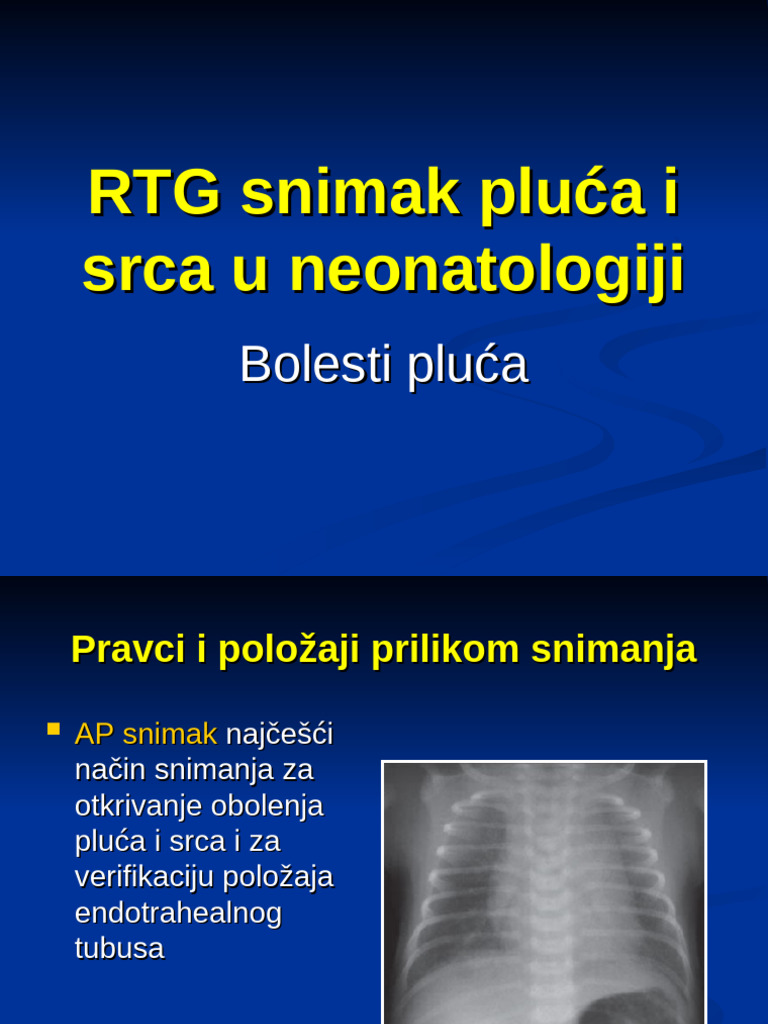 RTG Snimak Srca I Pluca U Neonatologiji | PDF