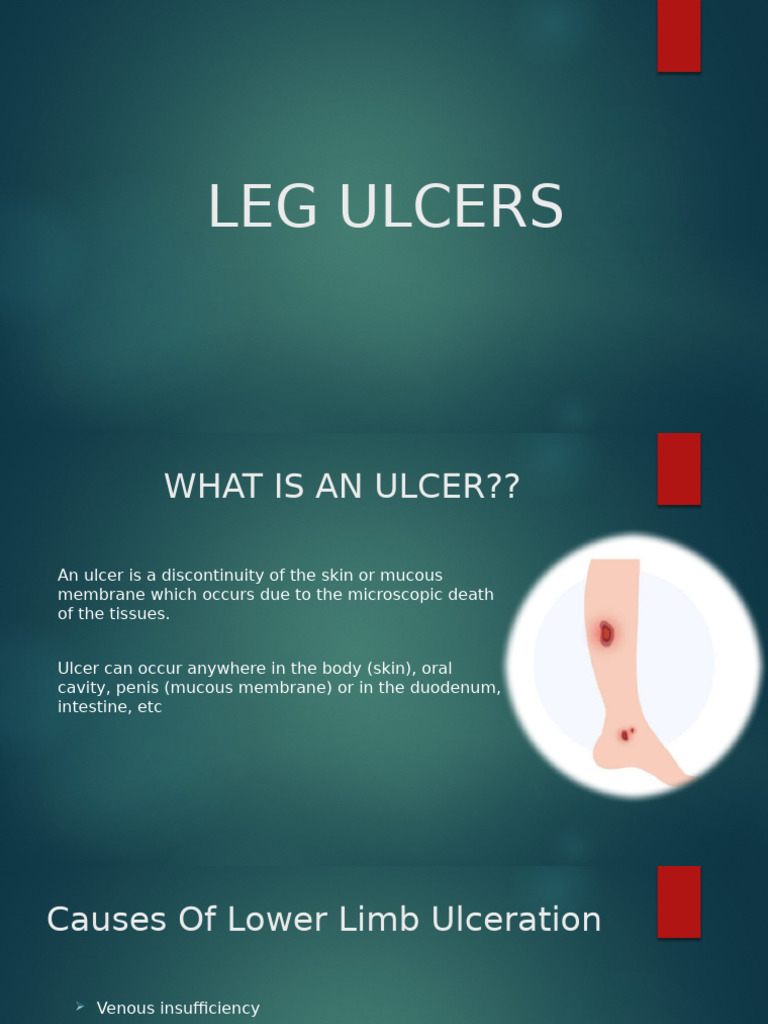 Leg Ulcers | PDF