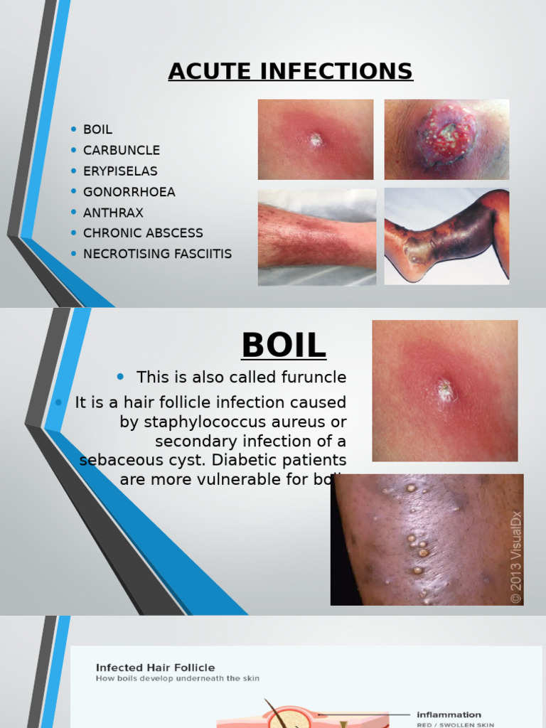 BOIL (1) Final-1 | PDF