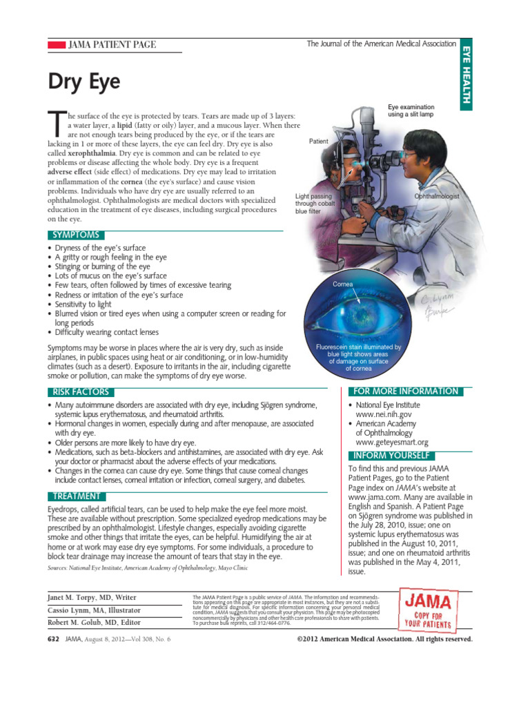Dry Eye | PDF