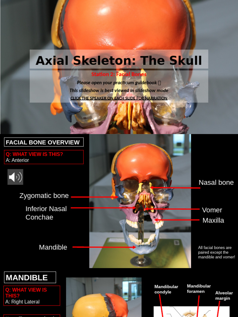 Station 2- Facial Bones 2024 | PDF