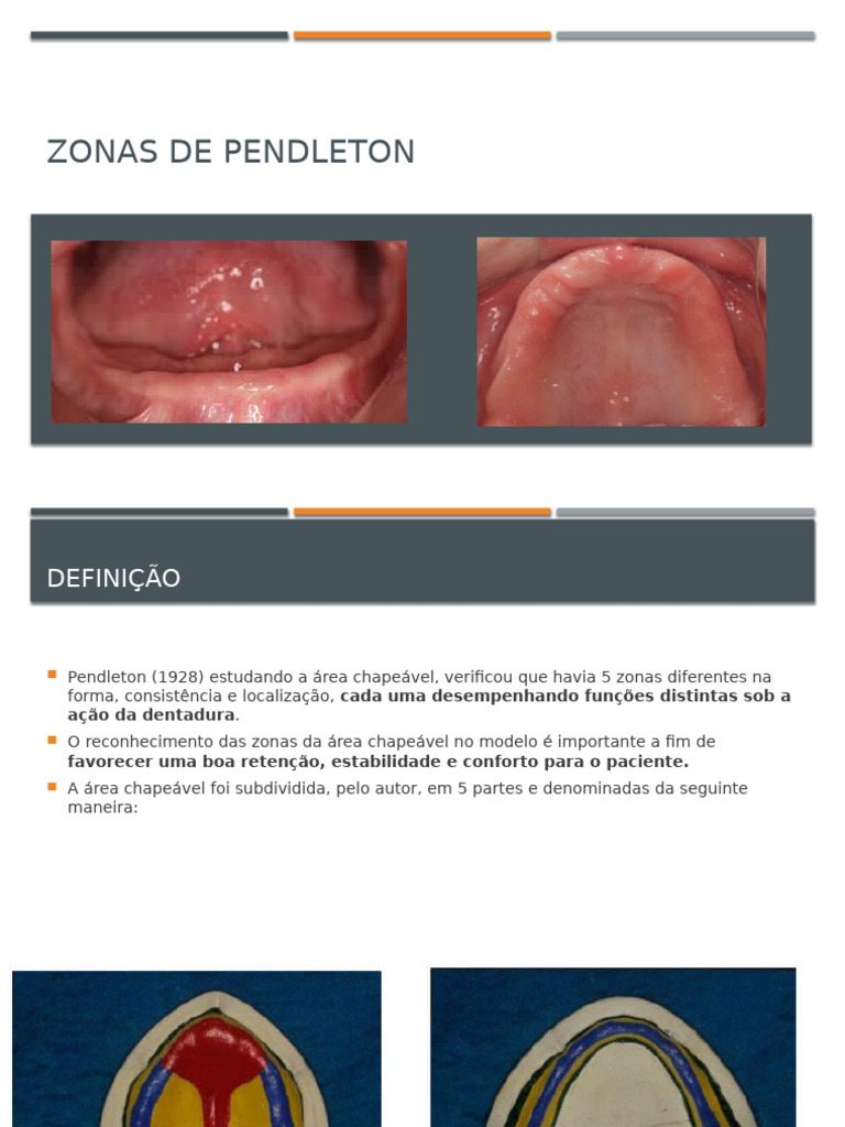 Zonas de Pendleton | PDF