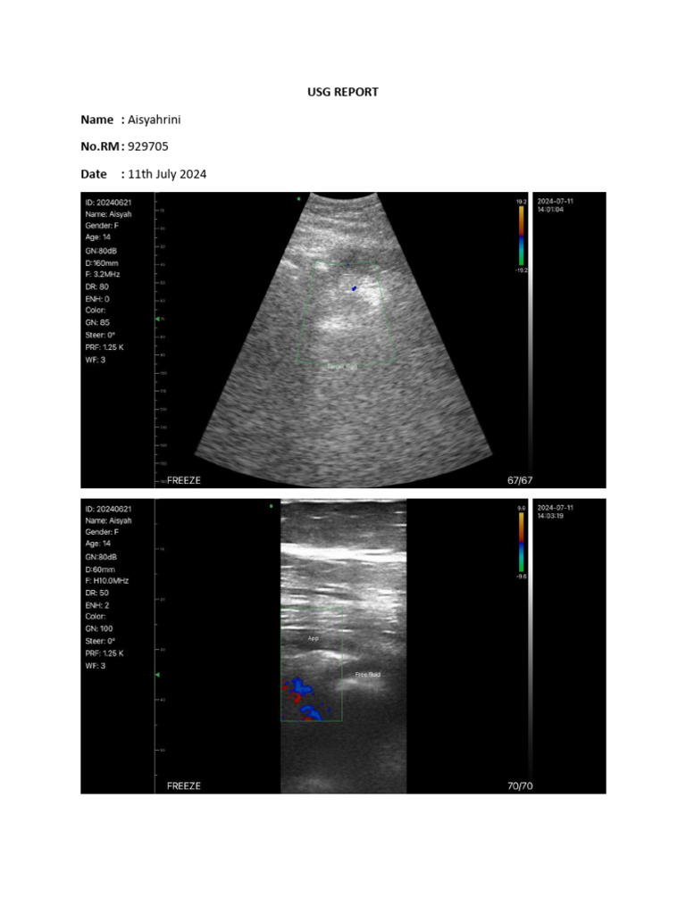 USG Report Aisyahrini | PDF