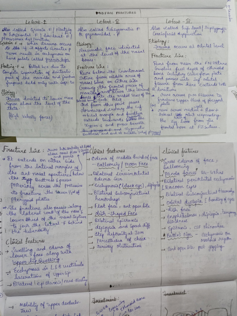 Maxillary Fracture | PDF