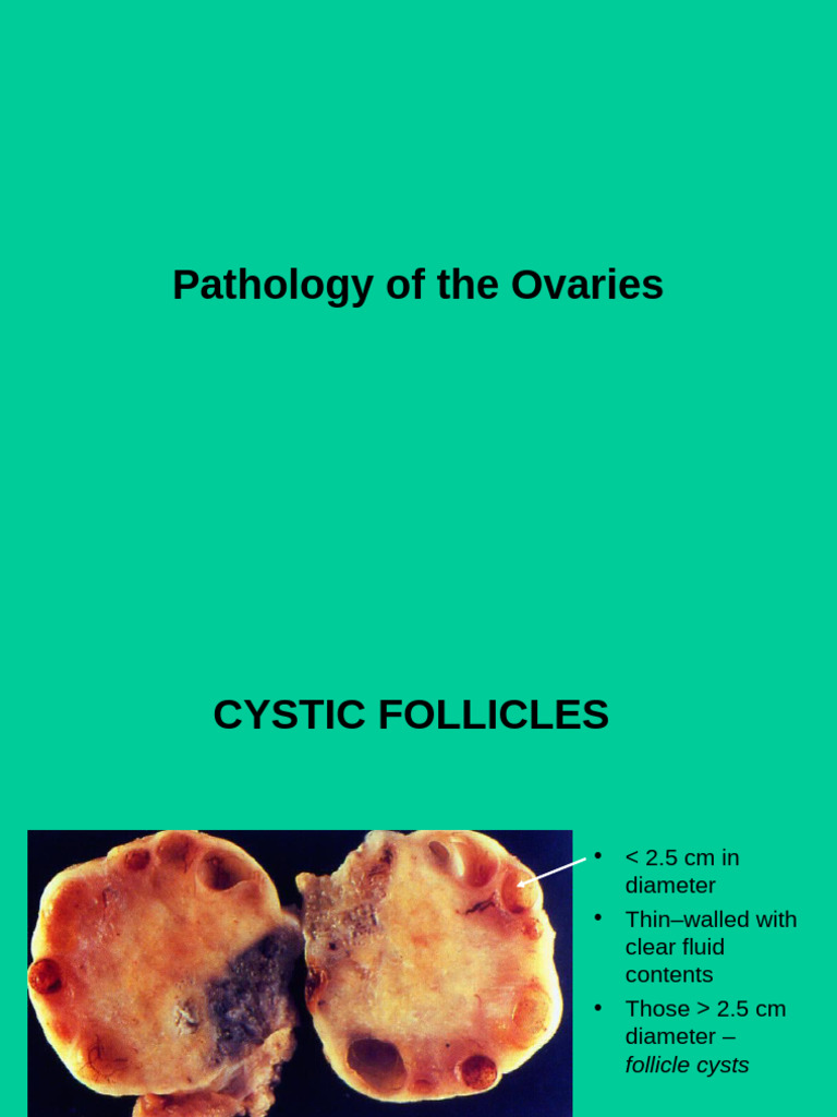 Ovaries | PDF