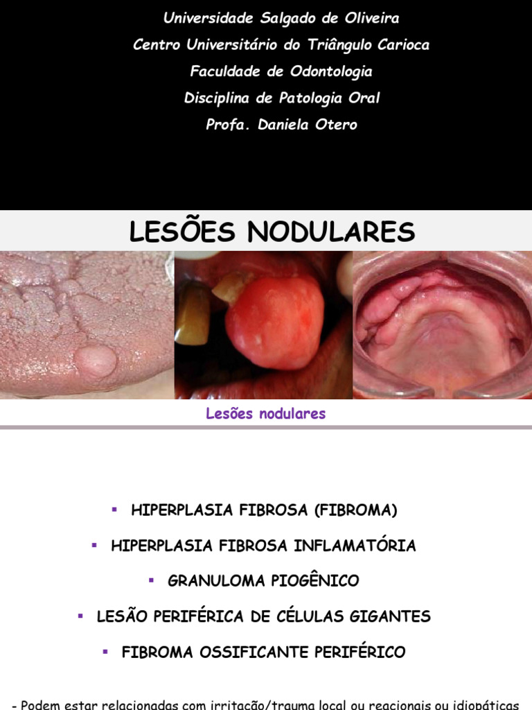 Aula P Lesões Nodulares | PDF