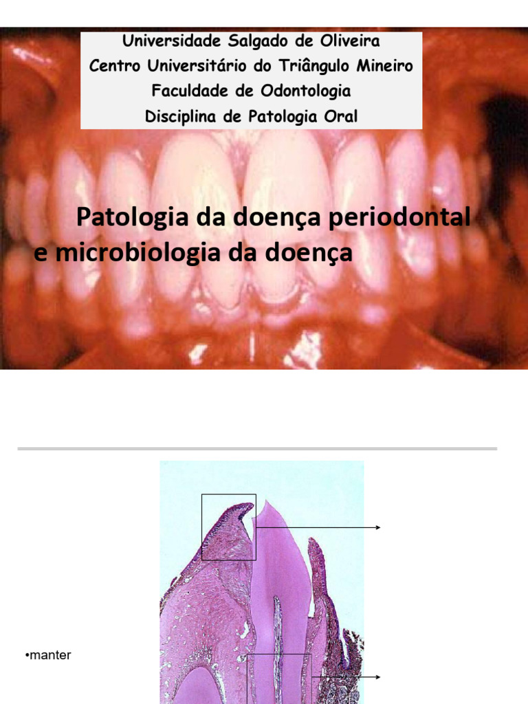 Aula de Doenca Periodontal | PDF