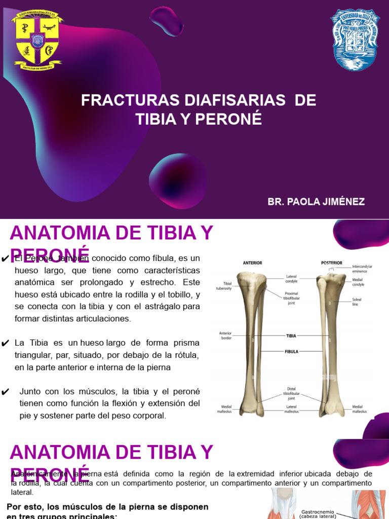 FX de Tibia, Perone y Tobillo | PDF | Tobillo | Rodilla