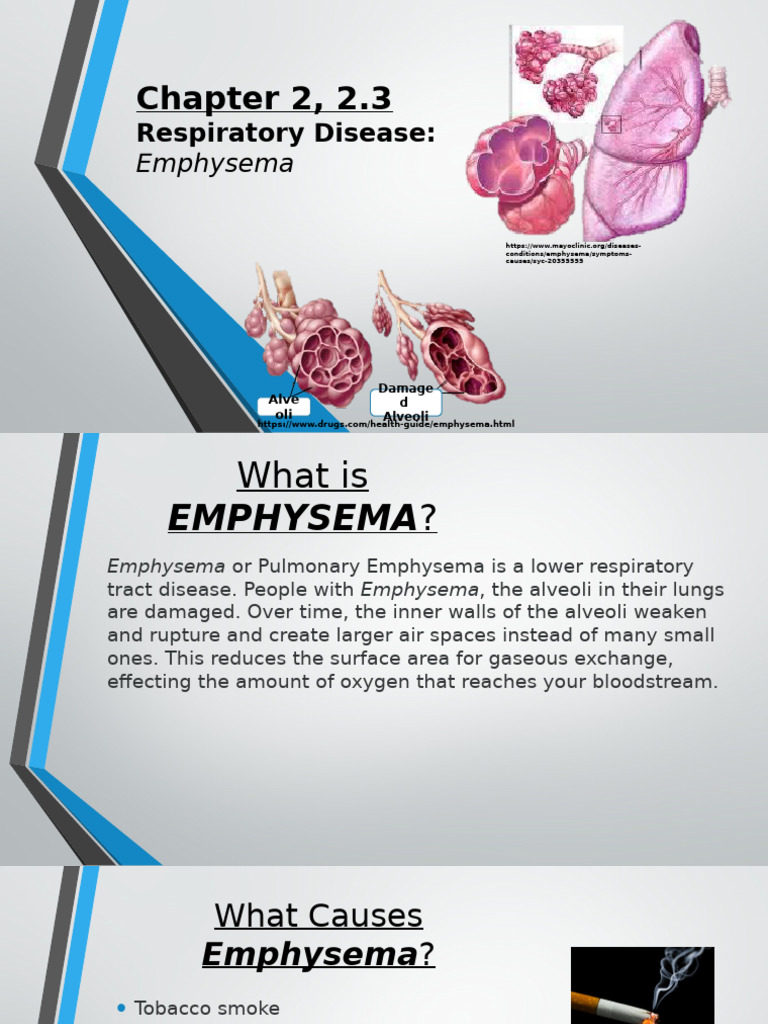 Emphysema (Sheng Fung) | PDF