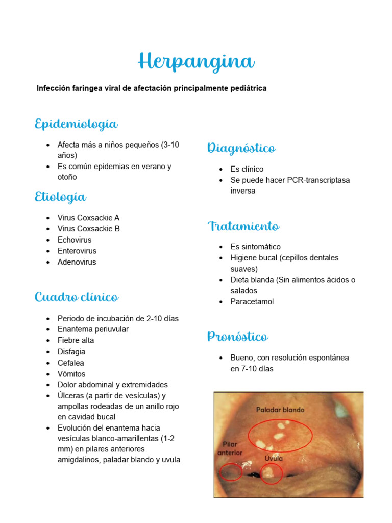 Faringoamigdalitis y Sinusitis | PDF