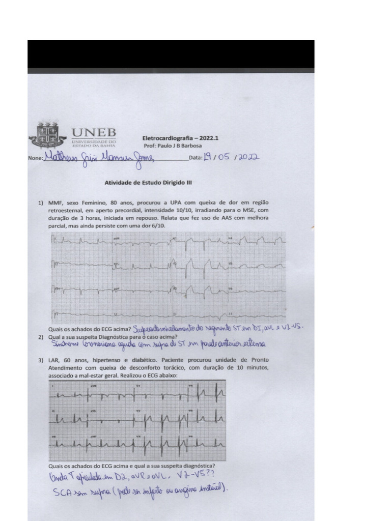 Ecg Ed3 | PDF